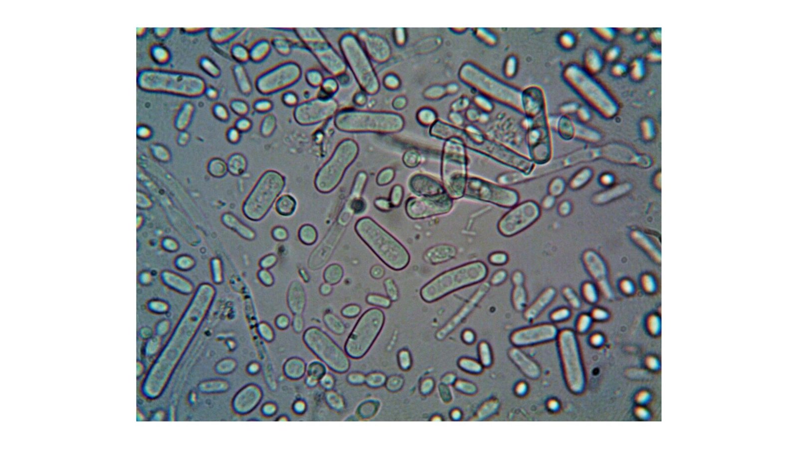 The Advanced Nutrient-Gathering Machine That Retains Micro organism ...